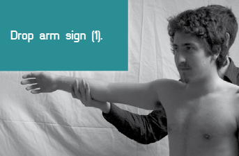 Drop arm sign 1 – La médecine du sport