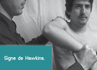 Signe de Hawkins – La médecine du sport