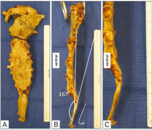 Les pathologies du thorax – Partie 2 – La médecine du sport